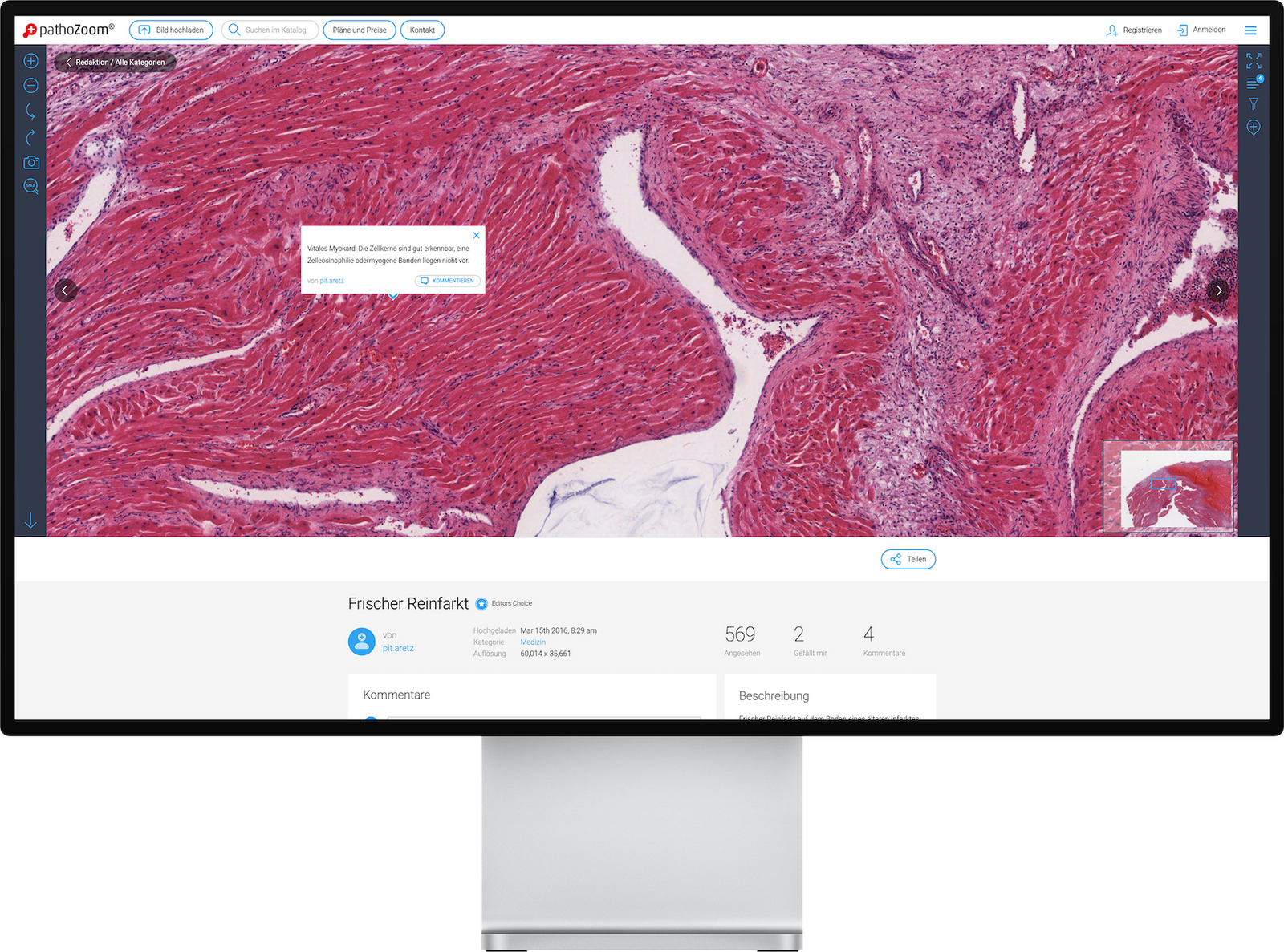 PathoZoom - Digital Pathology